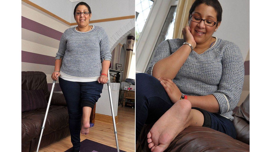 Le reconstruyen la rodilla con la articulación de su pie amputado ...