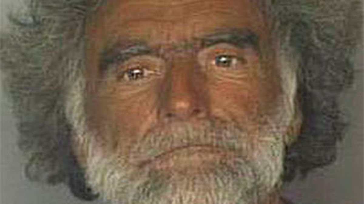 Las imágenes de la víctima del caníbal luego de las operaciones