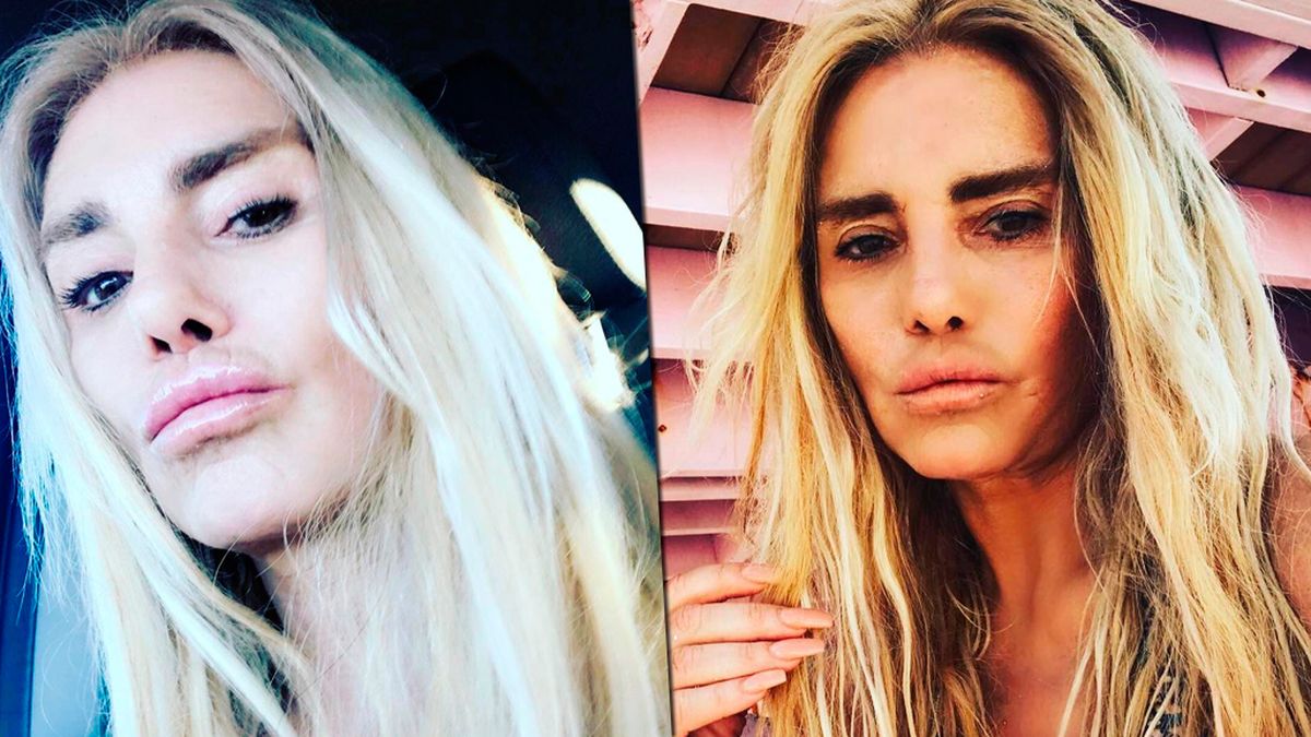 Habló la mamá de Silvia Rodríguez: Se cosió los músculos a la piel