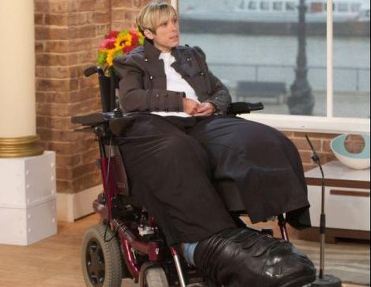 El increíble caso de la mujer con piernas que no paran de crecer