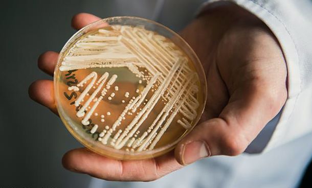 Confirman en Buenos Aires los primeros casos argentinos del hongo ...