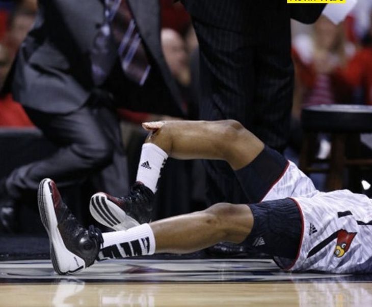 EE.UU.: impresionante lesión de un jugador de básquet universitario