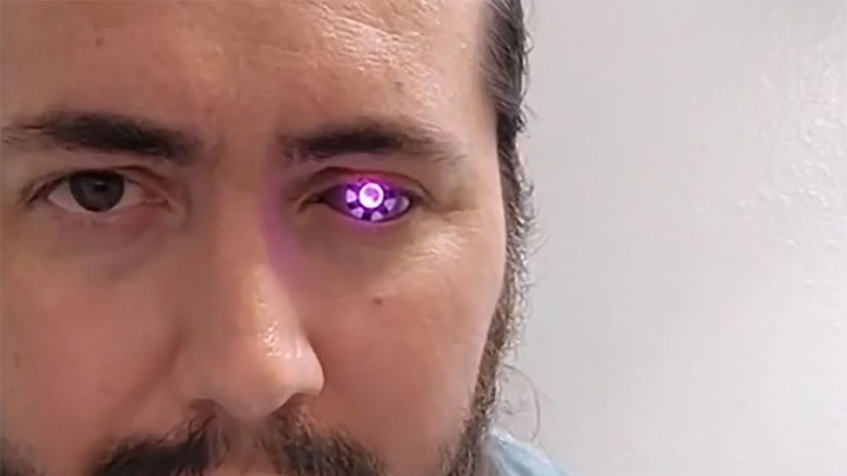Perdió un ojo y ahora transformó su cabeza en una linterna cibernética