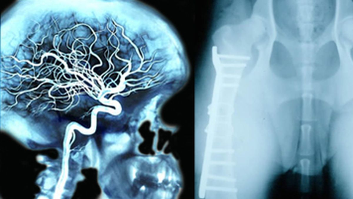 La visión rayos x de Superman ya dejó de ser ciencia ficción