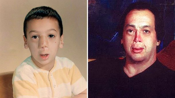 Lo abandonaron por desfigurado y, 40 años después, encontró a su madre