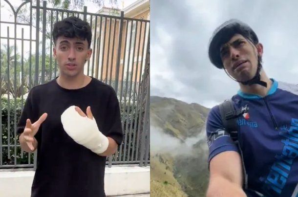 Gero Arias mostró cómo le quedó la mano tras la operación: Están ...