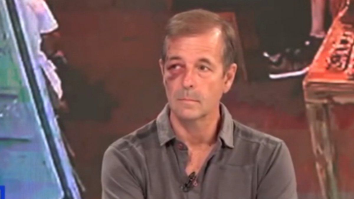 Mal momento: un periodista víctima de un robo debió ser operado de urgencia