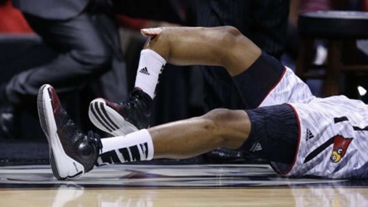 EE.UU.: impresionante lesión de un jugador de básquet universitario
