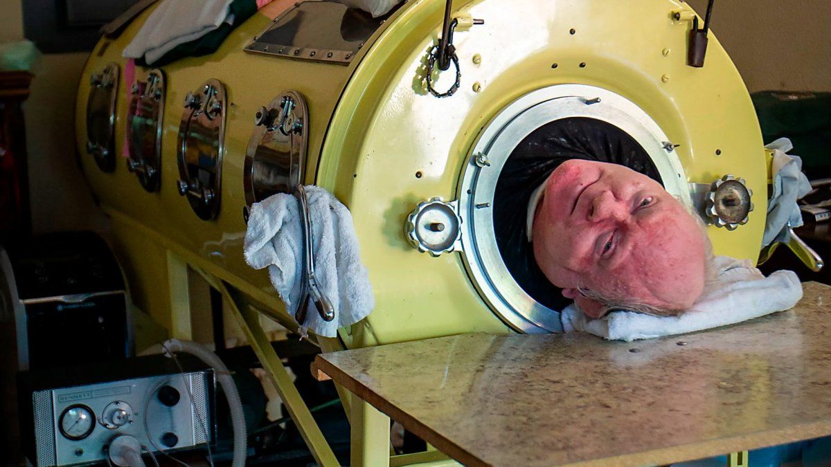 Murió Paul Alexander, el hombre que vivía con un pulmón de acero