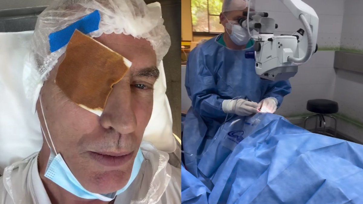 Marley se sometió a una cirugía en su ojo y compartió las imágenes del ...