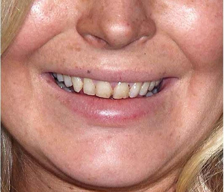 ¿Pero que pasó en esos dientes Lindsay?