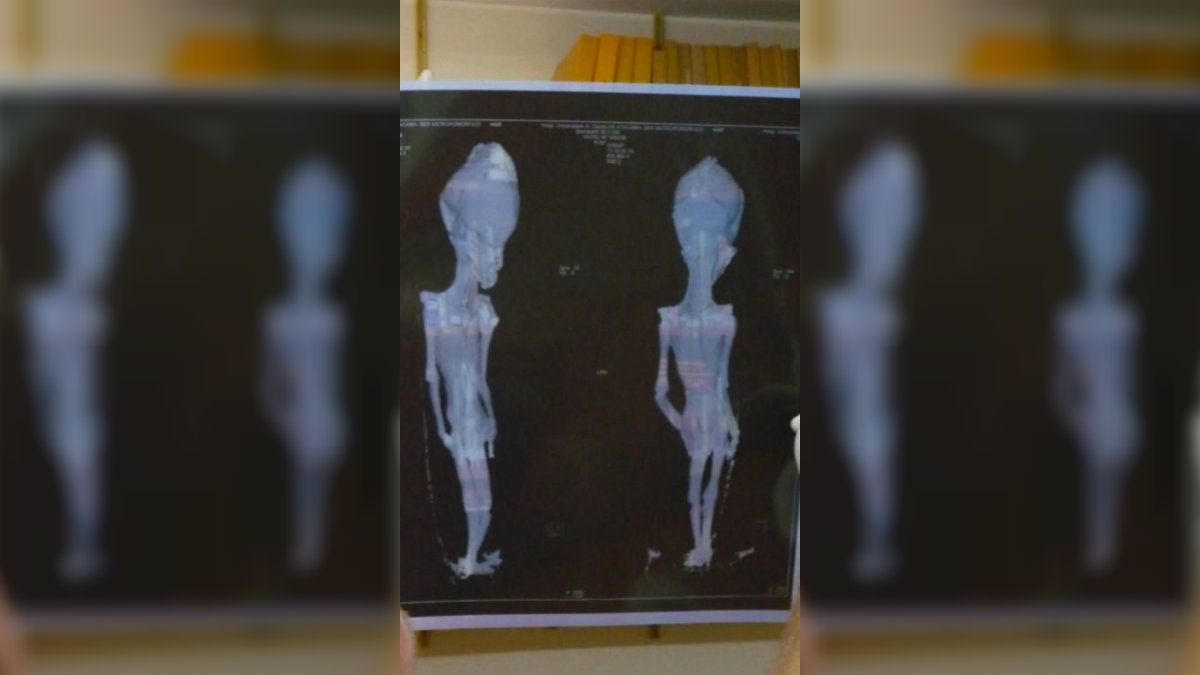 Después de 15 años, resolvieron el misterio de la momia alien de Atacama