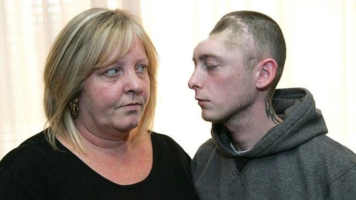 La increíble historia del hombre con el cráneo de titanio