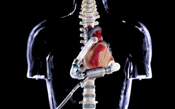 Crean corazón artificial que podría implantarse en el cuerpo humano